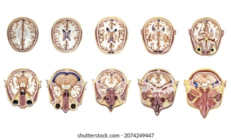 385 Human body brain diagram Stock Photos, Images & Photography ...