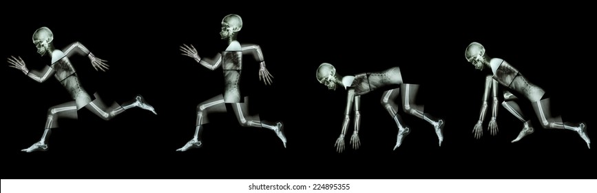 429 Xray running Images, Stock Photos & Vectors | Shutterstock