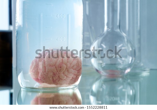 Human Brain Preserved Formaldehyde Science Experiments Stock Photo ...