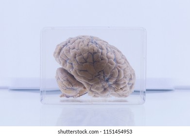 Human Brain Samples Stock Photo 1151454953 | Shutterstock