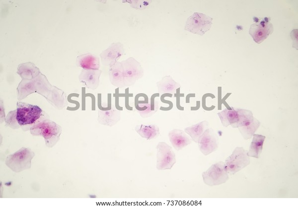 Human Buccal Smear Under Microscope Showing Foto Stok 737086084 ...
