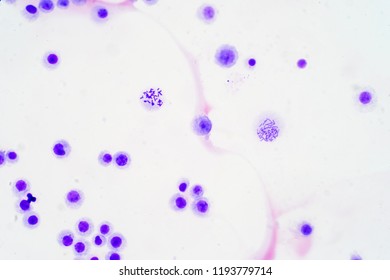 145 Chromosomes karyotype Stock Photos, Images & Photography | Shutterstock