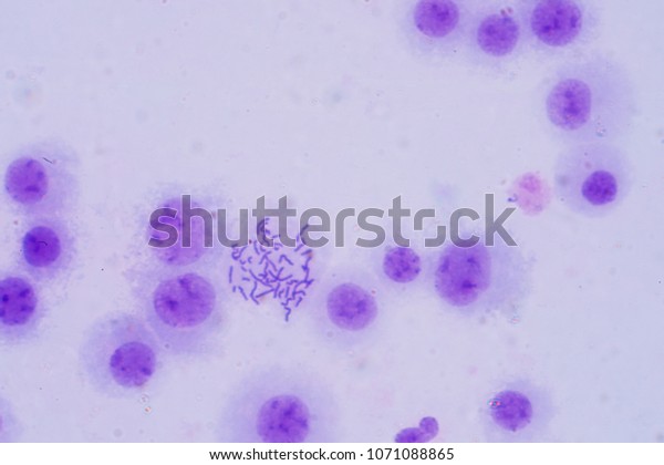 Human Chromosomes Under Microscope View Education Stock Photo ...