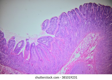Human Intestinal Wall Under Microscope Stock Photo 381019231 | Shutterstock
