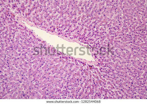 Human Liver Section Under Microscope Stock Photo (Edit Now) 1282544068