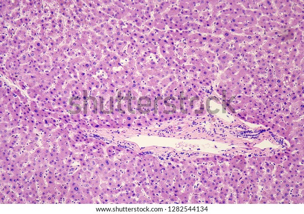 Human Liver Section Under Microscope Stock Photo (Edit Now) 1282544134