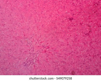 Human Liver Tissue Under Microscope View Stock Photo 549079258 ...