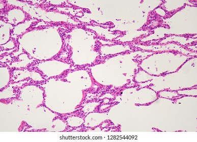 Human Lung Section Under Microscope Stock Photo (Edit Now) 1282544122