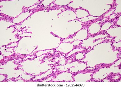 Human Lung Section Under Microscope Stock Photo (Edit Now) 1282544122