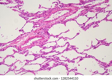 Human Lung Section Under Microscope Foto stock 1282544110 | Shutterstock