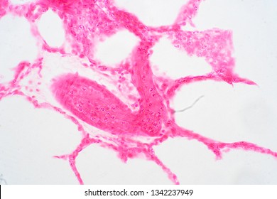 Human Lung Tissue Under Microscope View Stock Photo (Edit Now) 1342237949