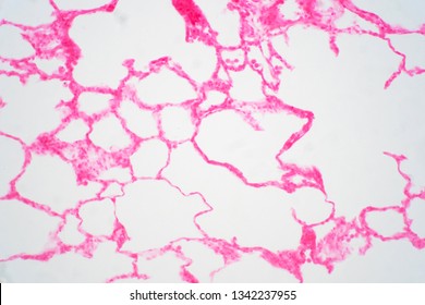 Human Lung Tissue Under Microscope View Stock Photo 1342237955 ...