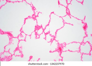 Human Lung Tissue Under Microscope View Stock Photo 1342237970 ...