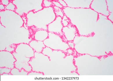 Photo de stock Human Lung Tissue Under Microscope View 1342237961 ...