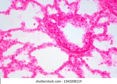 Human Lung Tissue Under Microscope View Stock Photo 1343208119 ...