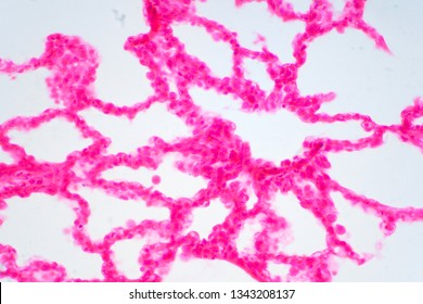 Human Lung Tissue Under Microscope View Stock Photo 1343208137 ...