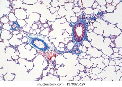 Human Lung Tissue Under Microscope View Stock Photo (Edit Now) 1379895638
