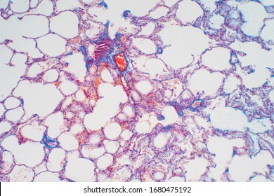 Human Lung Tissue Under Microscope Lungs Stock Photo 1680475192 ...