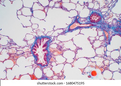 Human Lung Tissue Under Microscope View Stock Photo (Edit Now) 1379895638