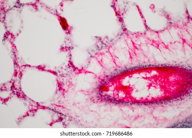 Human Lung Tissue Under Microscope View Stock Photo 719686486 ...