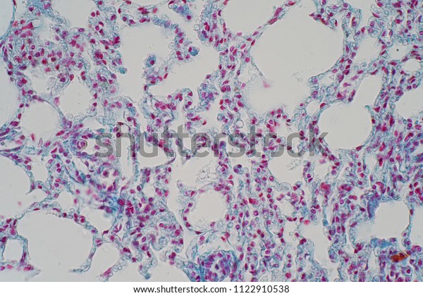 Human Lung Tissue Under Microscope View Stock Photo (Edit Now) 1122910538