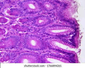 Human Uterus Under Microscope Stock Photo 1290947371 | Shutterstock