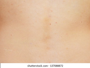 Human Skin Background Stock Photo 137088872 | Shutterstock
