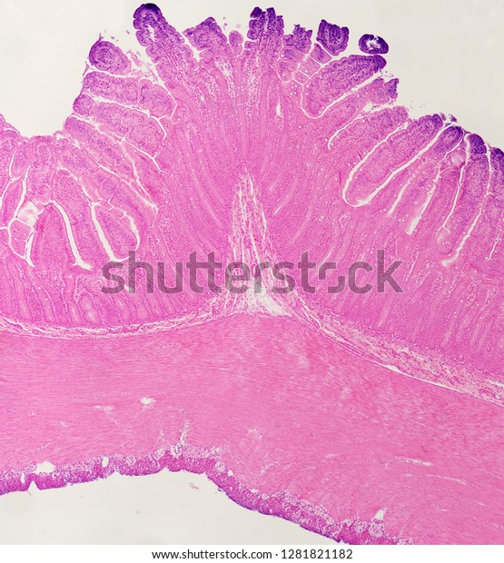 Human Small Intestine Duodenum Section Under Stock Photo 1281821182 ...