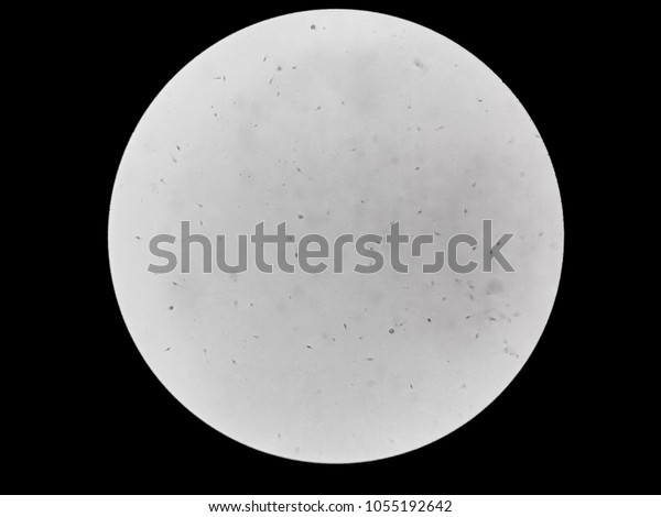 Human Sperm Cell Under Microscope Stock Photo 1055192642 | Shutterstock