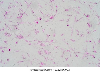 Human Sperm Morphology Under Microscope Micrograph 스톡 사진 1122909923 ...