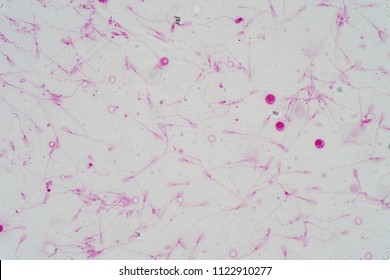 Human Sperm Morphology Under Microscope Micrograph Stock Photo ...