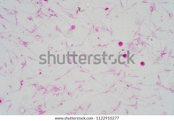 Human Sperm Morphology Under Microscope Micrograph Stock Photo ...