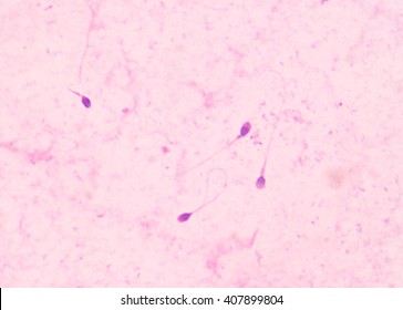 Human Sperms Wright Stain Stock Photo 407899804 | Shutterstock