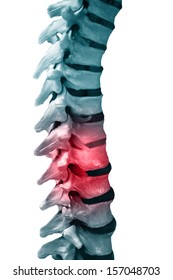 Human Spinalcolumn Model Isolated On White Stock Photo 157048703 ...
