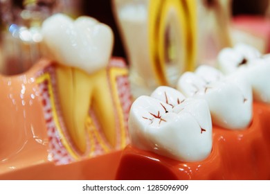 Human Teeth Layout Stock Photo 1285096909 | Shutterstock