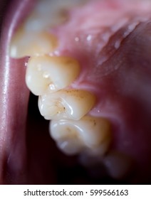 Human Teeth Macro Stock Photo (Edit Now) 599566163