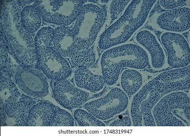 Human Testis Sec Under Microscope Stock Photo 1748319947 | Shutterstock