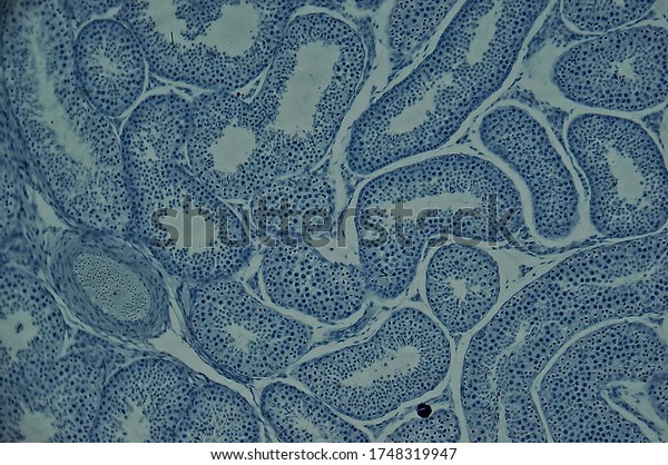Human Testis Sec Under Microscope Stock Photo 1748319947 | Shutterstock