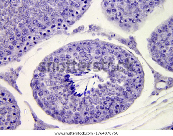 Human Testis Section Under Microscope Stock Photo 1764878750 | Shutterstock