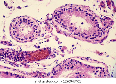 Cross Section Testis Tissue Under Microscope Foto Stok 1248887536 ...