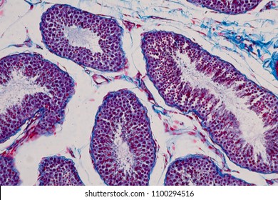 Human Testis Under Microscope View Shows Stock Photo 1100294516 ...