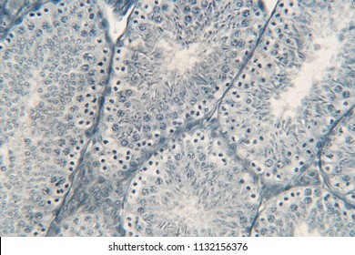 Human Testis Under Microscope View Shows Stock Photo (Edit Now) 1132156376