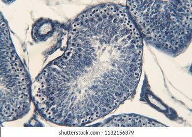 Human Testis Under Microscope View Shows Stock Photo 1132156379 ...