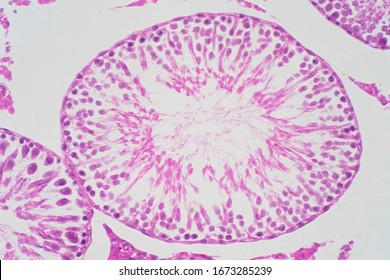 Human Testis Under Microscope View Shows Stockfoto 1673285239 ...