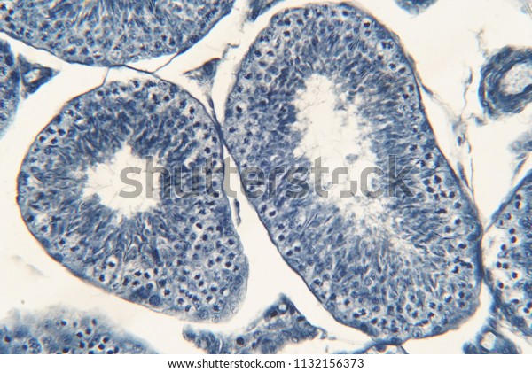 Human Testis Under Microscope View Shows Stock Photo 1132156373 ...