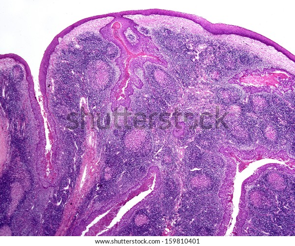 Human Tonsil Seen Light Microscope Low Stock Photo (Edit Now) 159810401