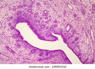 Human Uterus Under Microscope Stock Photo 1290947410 | Shutterstock