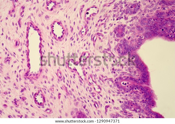Стоковая фотография 1290947371: Human Uterus Under Microscope ...