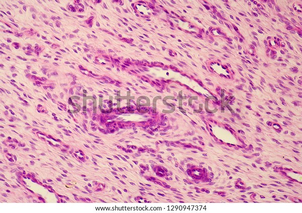 Human Uterus Under Microscope Stock Photo 1290947374 | Shutterstock