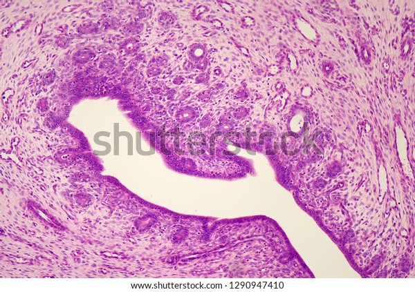 Human Uterus Under Microscope Stock Photo 1290947410 | Shutterstock